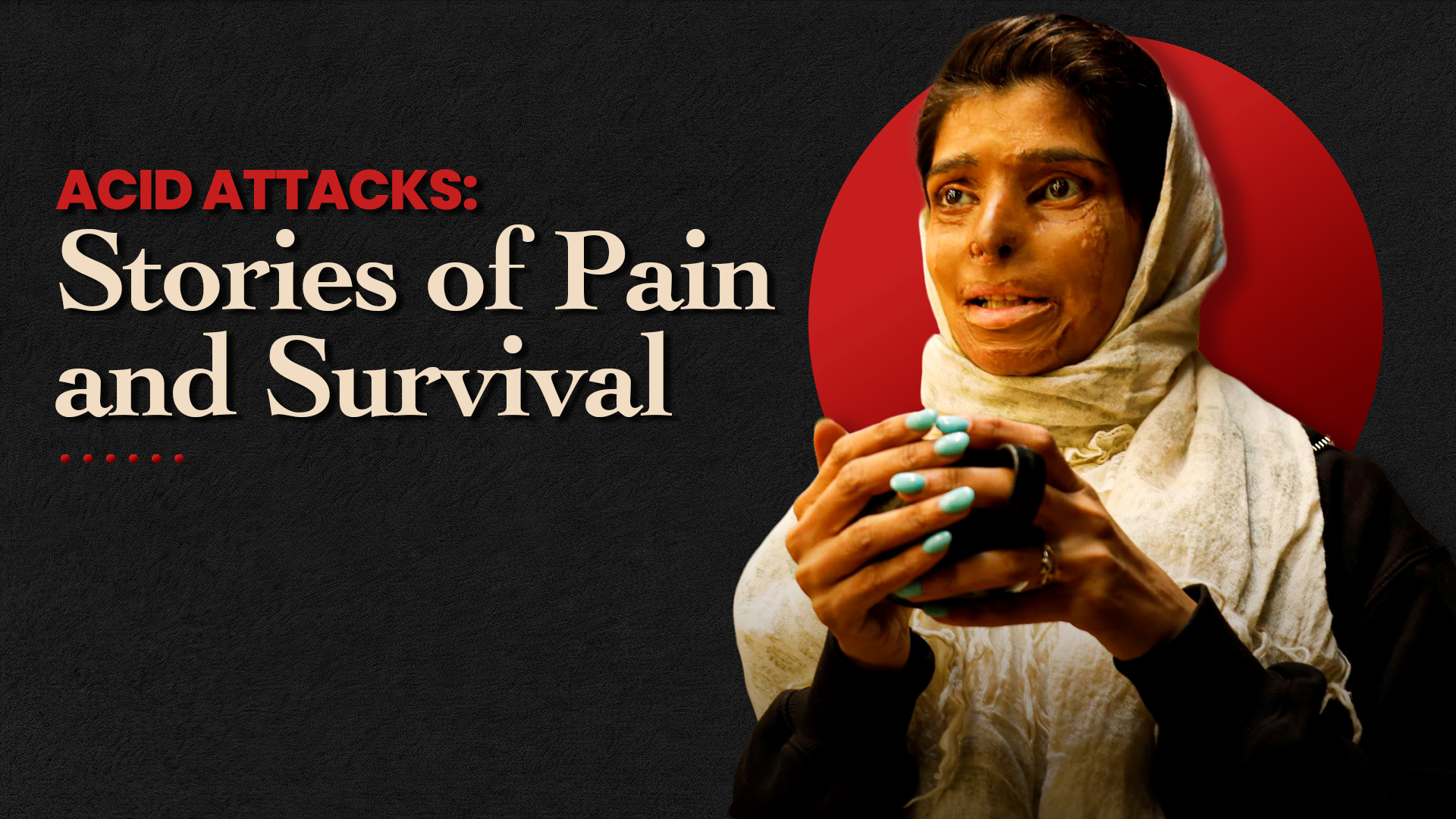 Acid Attack Survivors Continue to Suffer Ordeals | NewsClick